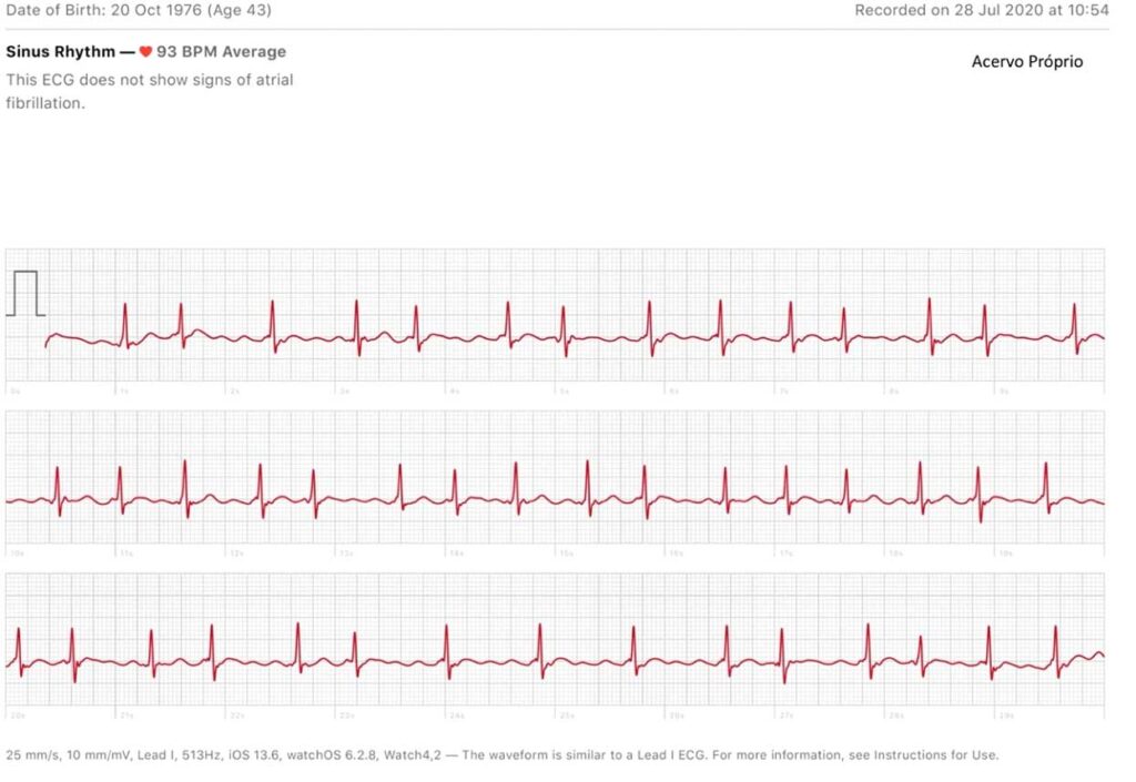 How to use digital devices to detect and manage arrhythmias: a ...